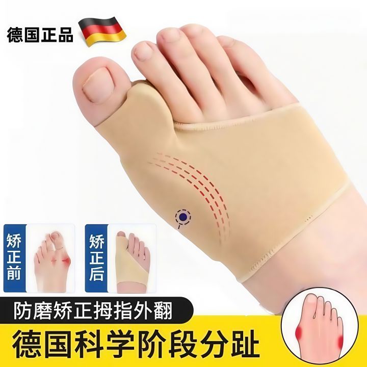Wearable Shoe Toe Corrector Anti-Wear Big Toe Outward Deviation ...