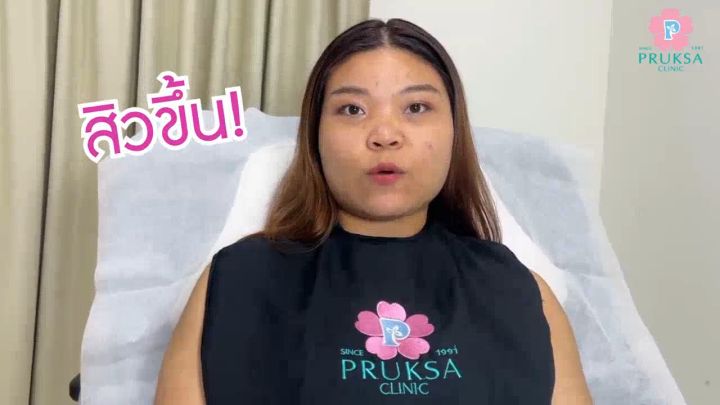 [E-Voucher] Pruksa Clinic Acnet Program (แอคเนทโปรแกรม) หน้าใสและรักษาสิวไปพร้อมกัน | Lazada.co.th