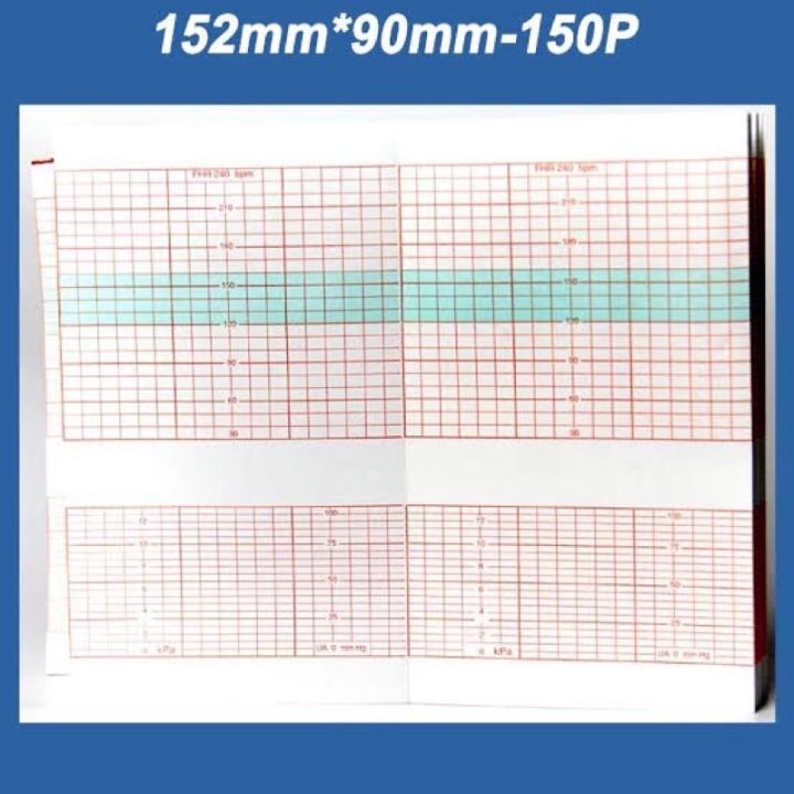 CTG Paper / Fetal Monitor Paper 152mm x 90mm x 150sh for EDAN F6, F9 ...