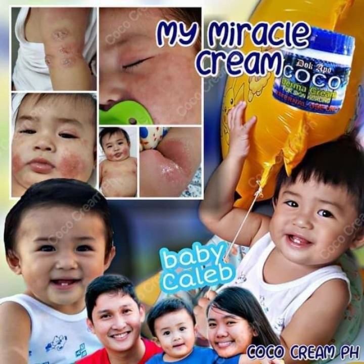 Coco Derma Cream Original (AUTHENTIC) | Lazada PH