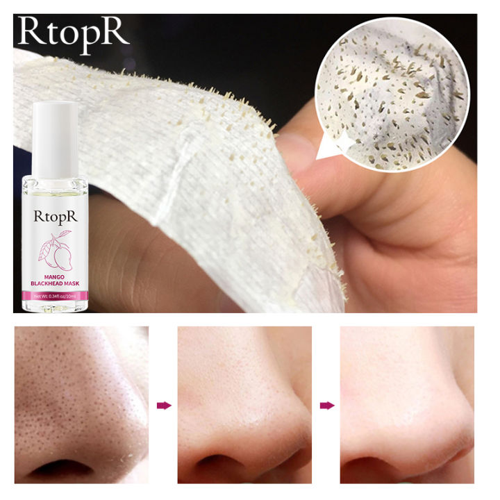 RtopR Mango Blackhead Remover Mask Deep Cleans Pores Acne Treatment ...