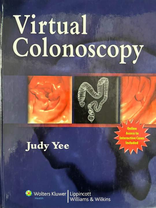 Virtual Colonoscopy | Lazada