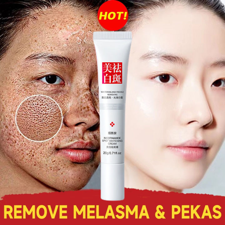 Brighten skin colour for face melasma and pekas remover original ...