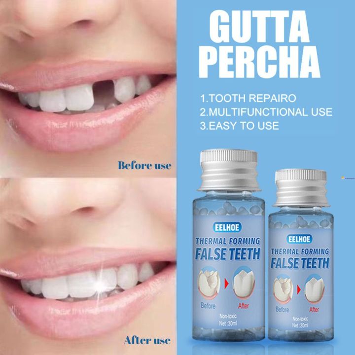 EELHOE 250/500/1000/1500 Dental filling Temporary Teeth Repair Kit ...