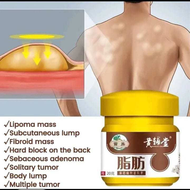 BAO JIAN GAO | Ampuh mengobati lipoma, mengurangi peradangan ...