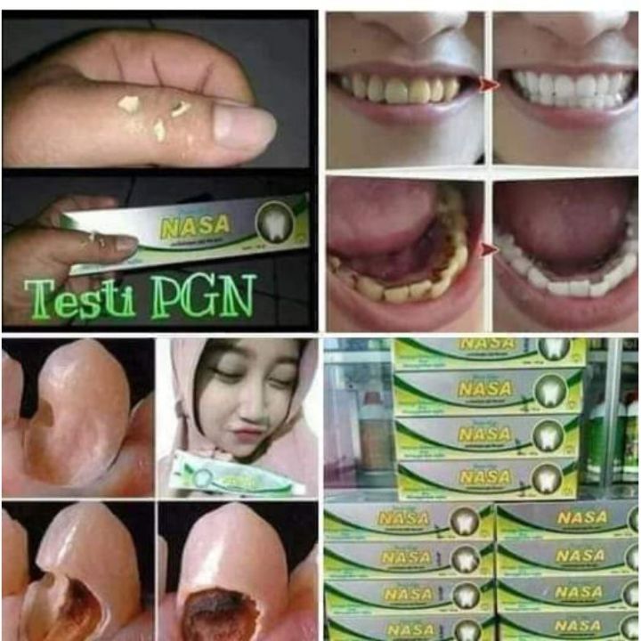 pasta gigi/pasta gigi nasa/odol/penghilang bau mulut/penyegar muluy ...