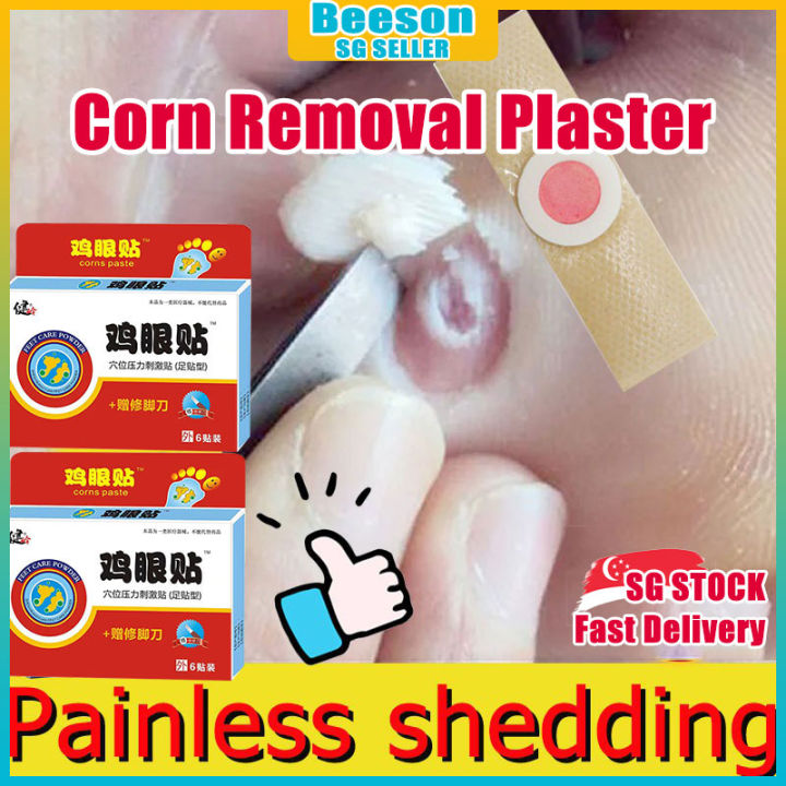 ⭐️SG STOCK⭐️ Corn removal plaster / Painless removal chicken eye / Corn ...
