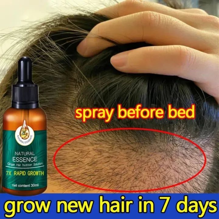 Semprotan Penumbuh Rambut Hair Growth Serum Hair Growth Spray Repair ...