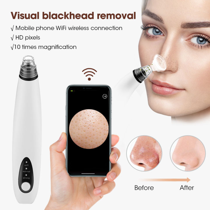 WiFi visual electric blackhead remover with camera vacuum pore cleaner ...