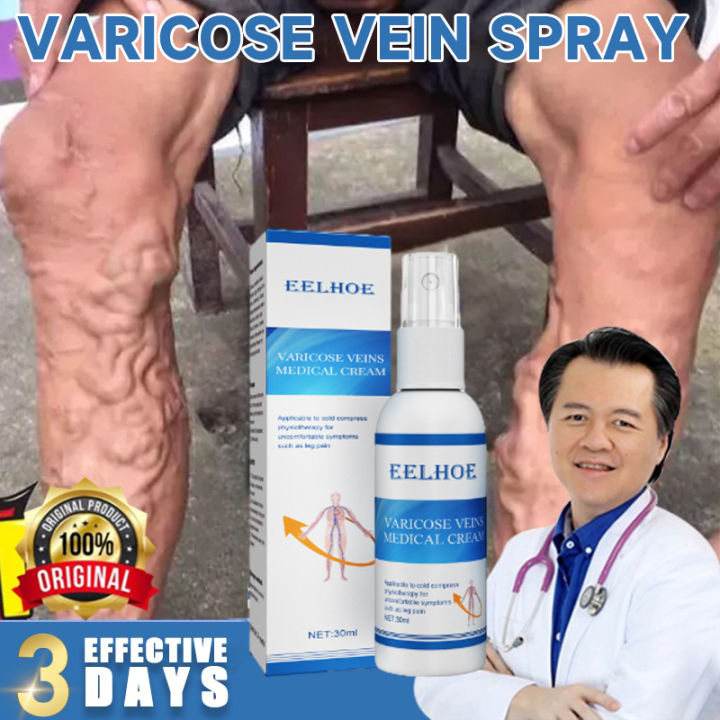100% original and effective varicose vein treatment spray Improve Vein ...
