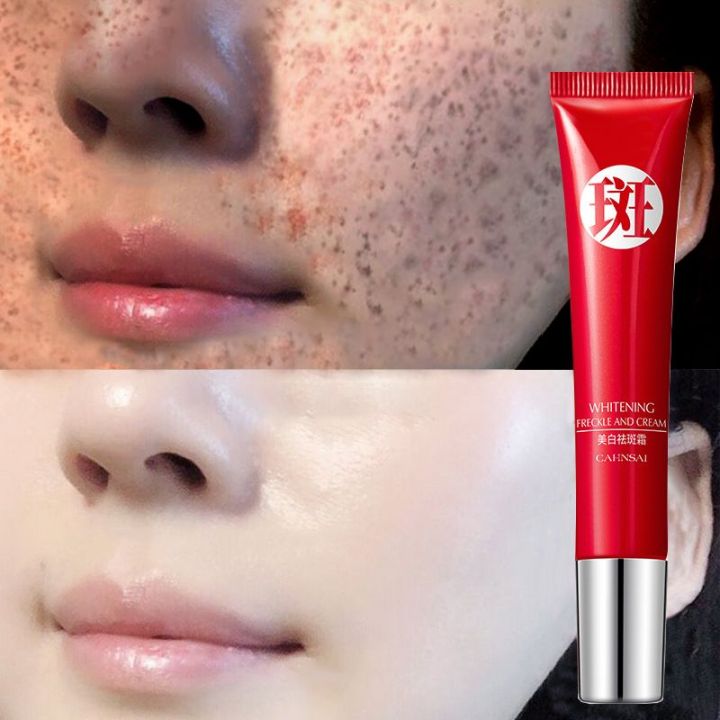 Original Strong Anti Freckle Whitening Cream Powerful Removing Age Dark ...