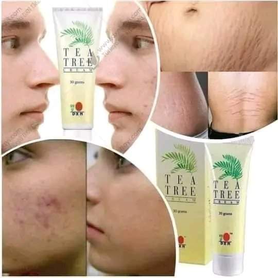 TEA TREE CREAM 30 ML | Lazada