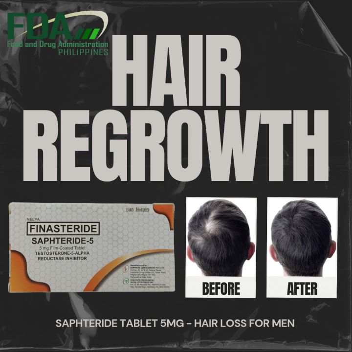 FINASTERID SAPHTERIDE | HAIR LOSS FOR MEN | 5mg Tablet | Lazada PH