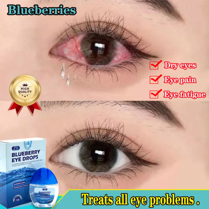 （Buy 1 Take 1）Blueberry Eye Drops Itchy Relieves Dry Eyes Sore Red Eyes ...
