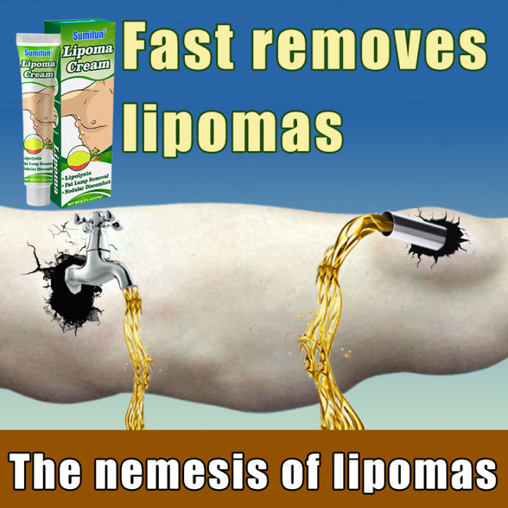 SUMIFUN Lipoma removal ointment, lump cream, lipoma cream, natural ...