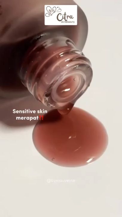 YOU 12% & 6% ACID INTENSIVE PEELING SERUM AHA BHA PHA Serum Eksfoliasi ...
