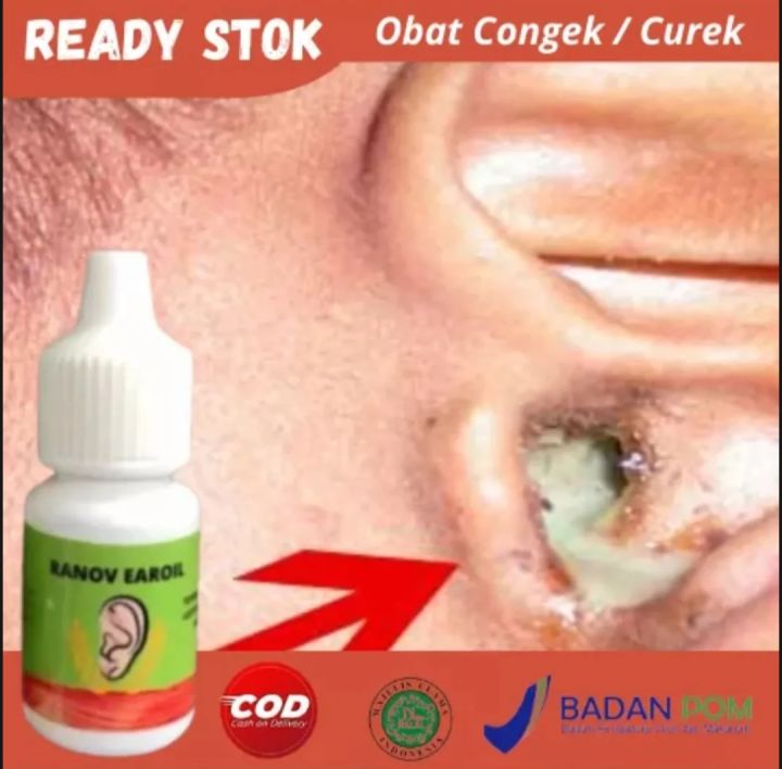 Obat Penyakit Telinga Bernanah Berair Bau Congean Keluar Cairan Kuping ...