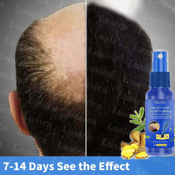 ⚡5 Days Fast Hair Growth⚡eelhoe Hair Growth Spray 30ml Fast Powerful