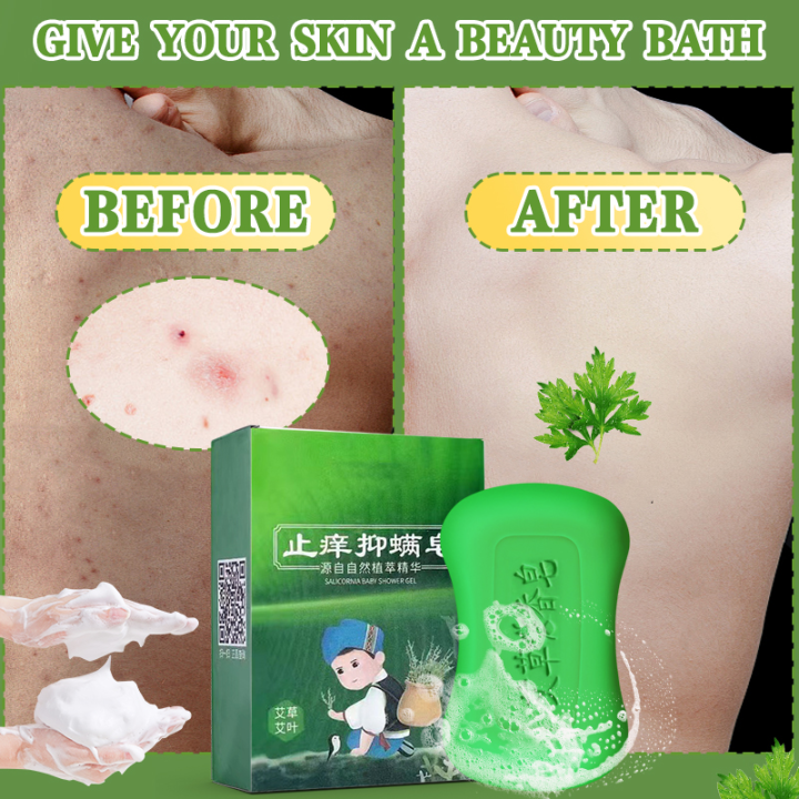 100% Natural & Organic Mugwort soap (Anti Itching and Anti Mite Soap Anti Acne Body Wash mite ...