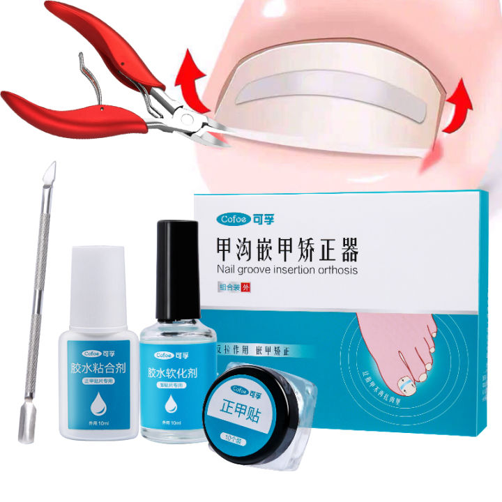 Cofoe Ingrown Toenail Corrector Full Set Nail Clippers Cutters Toe Nail ...