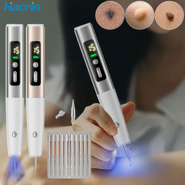 Facial Spot Wart Tag Tattoo Removal Pen Black Pore Dark Spot Remover ...