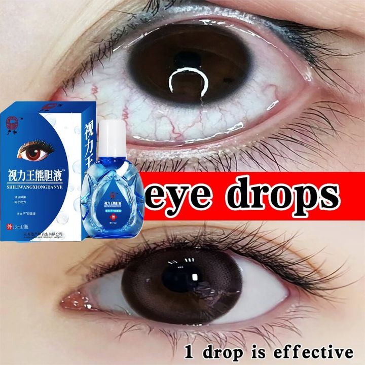 Eye Drops for dry eye Eye Care Relieve Red Blood Streaks Visual Fatigue ...