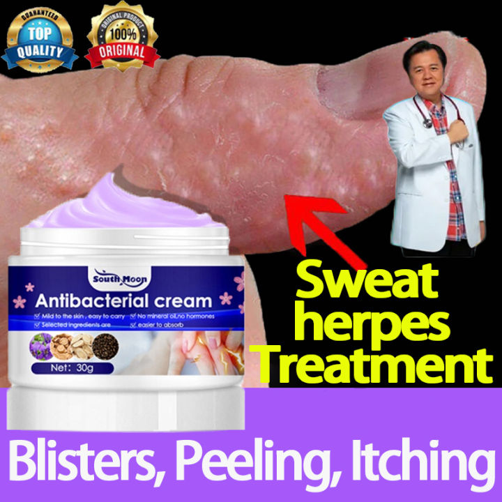 3 Seconds To Relieve Itching Sweat Herpes Treatment Eczema Treatment Cream Atoderma Cream ...