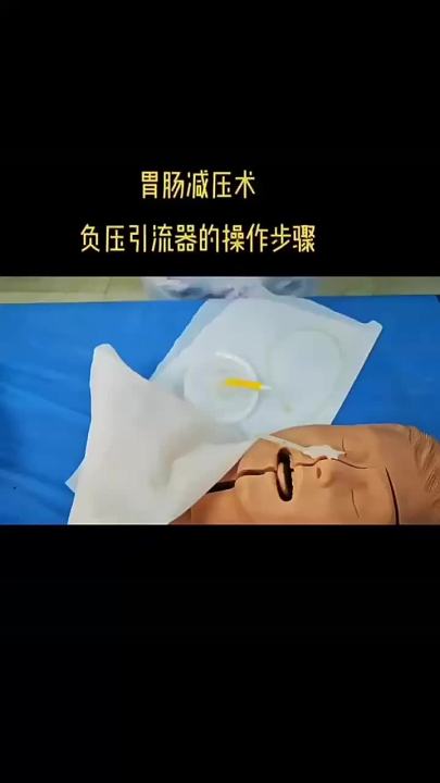 Changfeng Negative Pressure Device Gastrointestinal Drainage Pressure ...