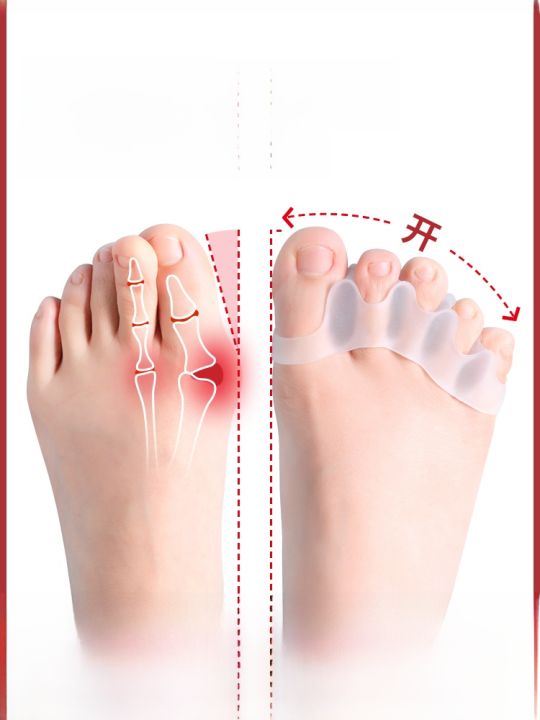 XIANZHAO | Ankle Foot Orthosis Toe Spreader Adult Women's Shoe ...