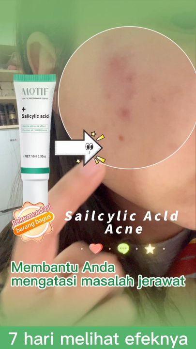 MOTIF Salicylic Acid Acne Spot Treatment Gel 10g Acne Treatment Anti ...