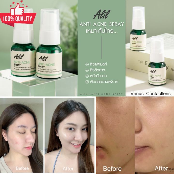 (แท้ 100%🇯🇵) Alil anti acne spray ปริมาณ 20ml. สเปรย์คุมสิว คุมมัน แพ้ ...