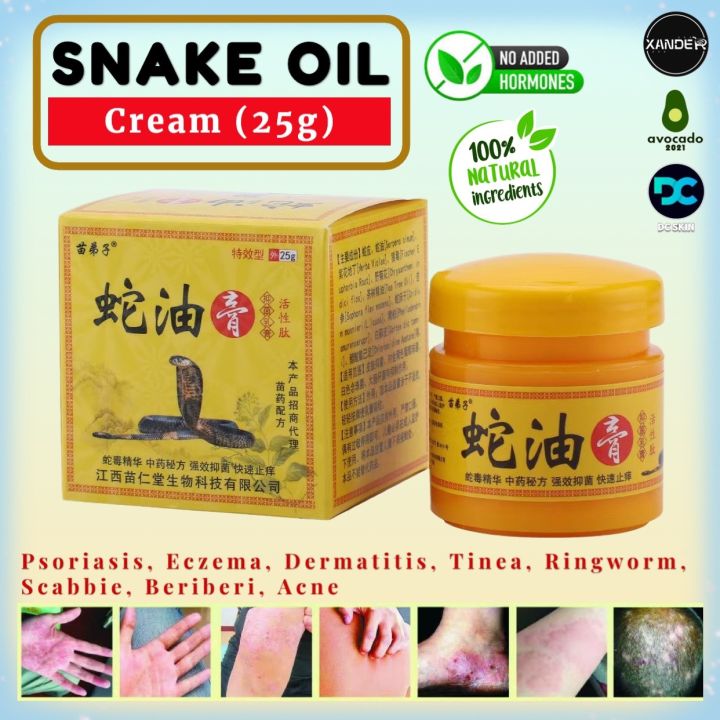 SNAKEOIL Eczema Psoriasis Cream 25g Ringworm Fungal Dermatitis Beriberi ...