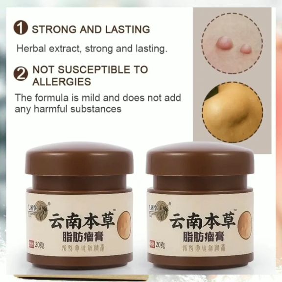 Lipoma Cream Bukol Oitment Removal Treat Tumor Treatment Skin Swelling ...