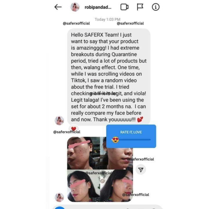 Saferx - Acne Treatment Set - Acne Treatment Set Acne Care - Acne ...