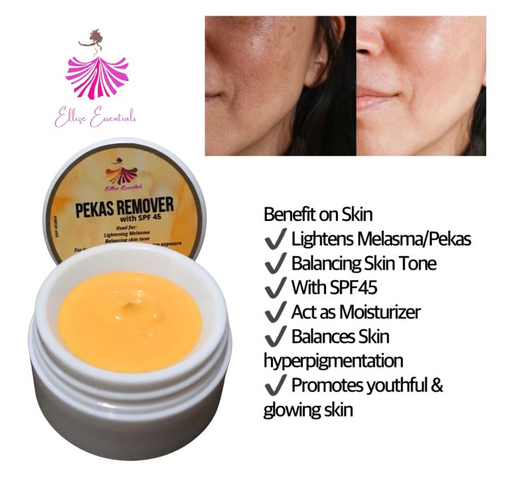 Pekas Remover Cream/ Melasma Remover 10g | Lazada PH