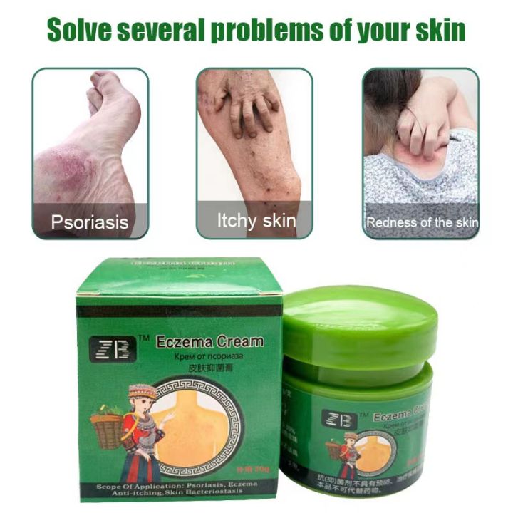 Zb 20g Antibacterial Skin Psoriasis Cream Dermatitis Eczematoid Eczema
