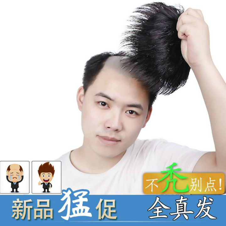 Bộ Tóc Giả Nam Giả Mạo Tóc Thật Che Phủ Tóc Trắng Cho Nam Trung Niên Và ...