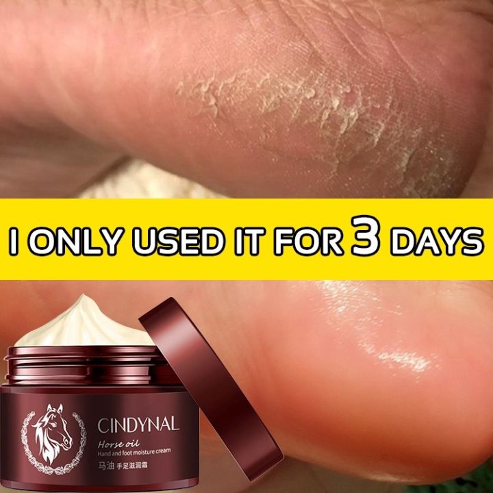 CINDYNAL Original horse oil Hand and Foot Salve Cream 110g anti ...