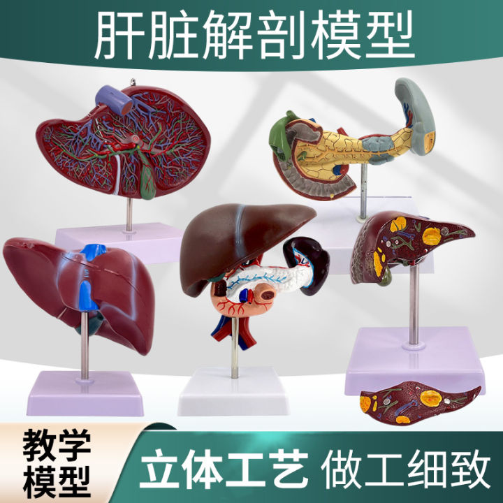 Artificial Human Liver Model Liver Anatomy Model Liver-Gallbladder ...