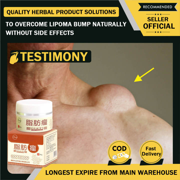 lipoma cream ubat benjolan Lipoma Removal Cream for Removing Multiple ...