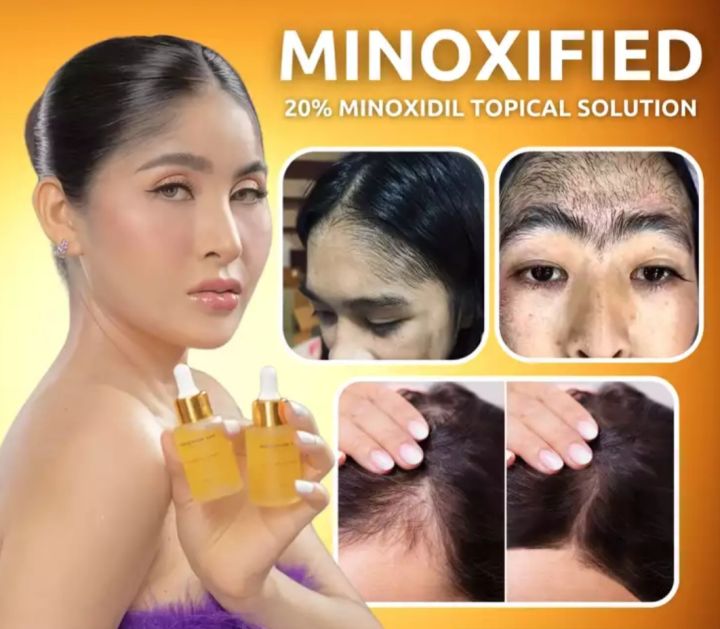 MINOXIFIED Topical Solution - Hair Grower | Lazada PH