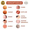 Salep Gatal Kulit Huatuobaifuling Krim Anti Gatal Eksim Alergi Kulit ...