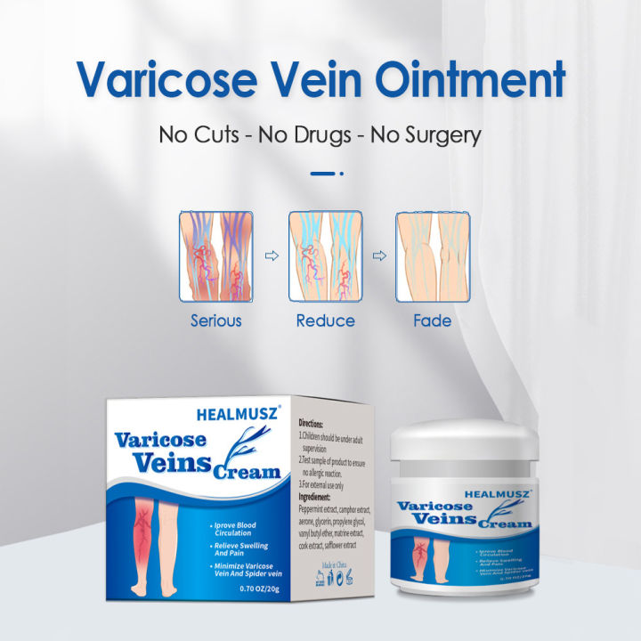 Varicose Vein Cream Natural Herbal Eliminate Vasculitis Phlebitis ...