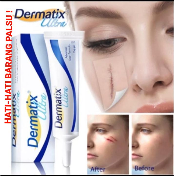 AWAS PALSU ! Salep Dermatix Ultra gel 15gr Original scan barcode ...