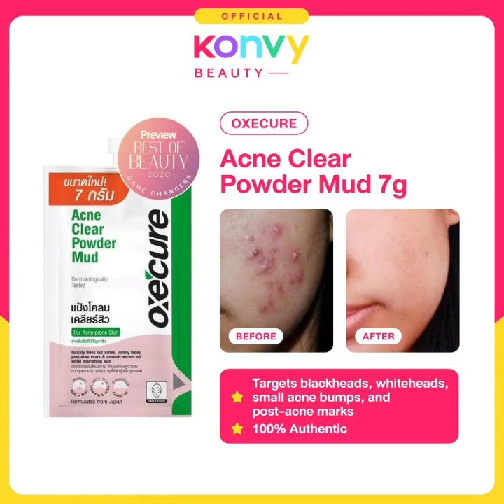 OxeCure Acne Clear Powder Mud 7g (For Acne-Prone Skin; Pimples ...
