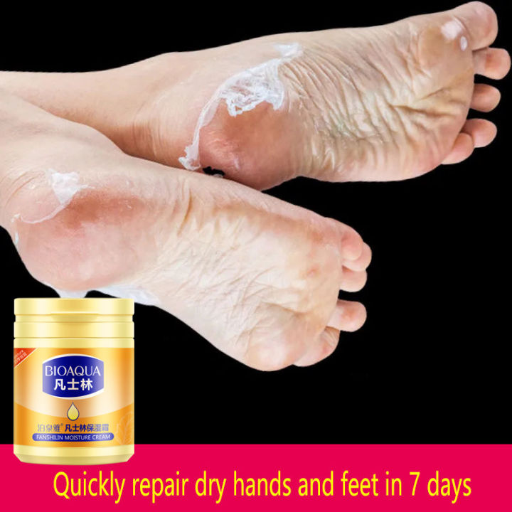 YIMIAOSI Vaseline Skin Moisturizer skin moisturizer cream Whitening ...