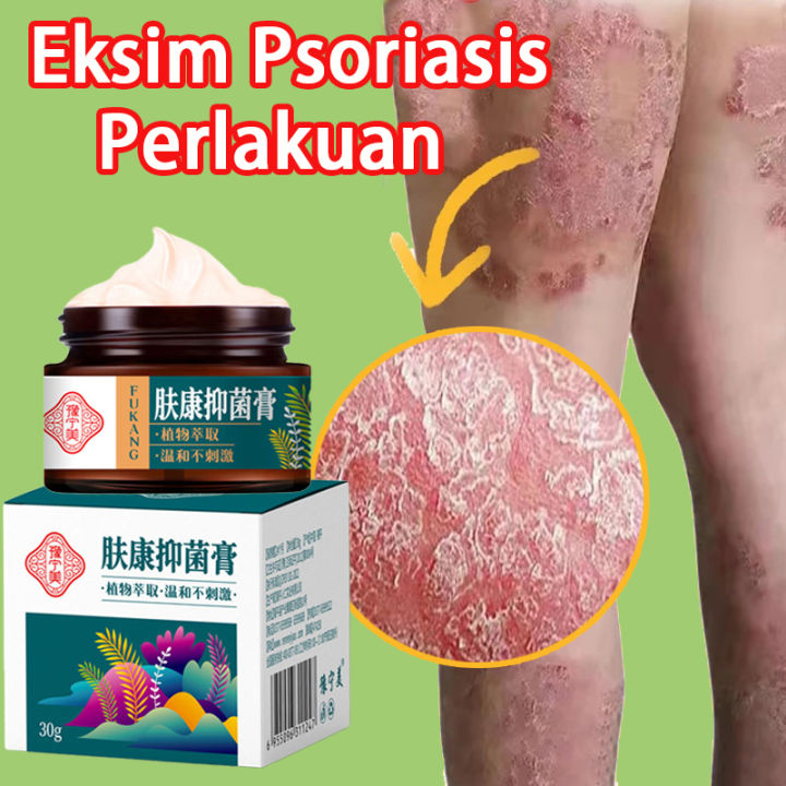 【100% Original】Salep gatal paling ampuh Obat psoriasis obat gatal salep ...