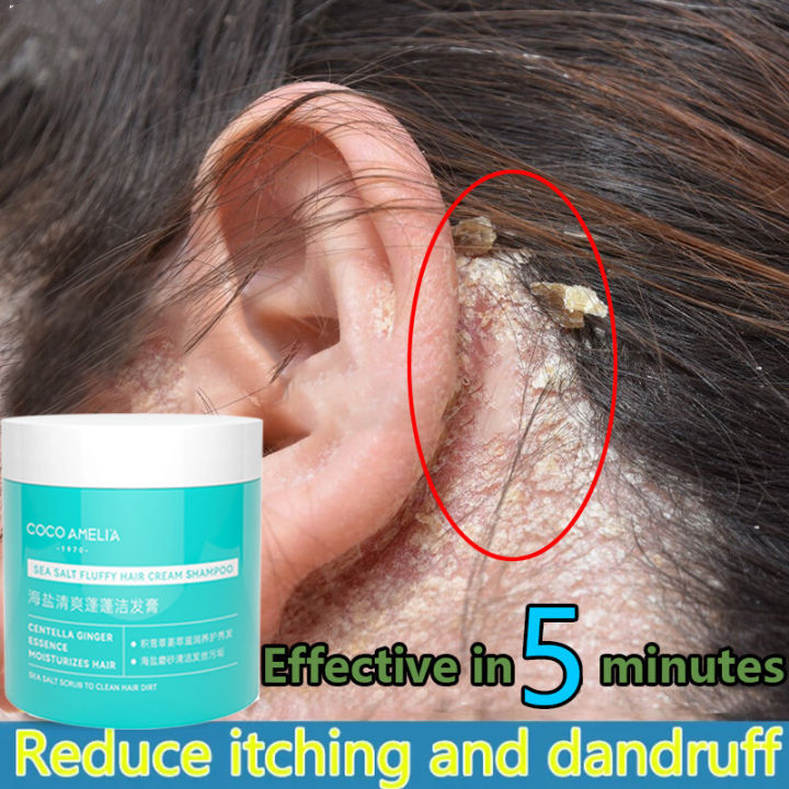 CCA Sea Salt Shampoo Anti-Dandruff Refreshing Oil Control Deep Scalp ...