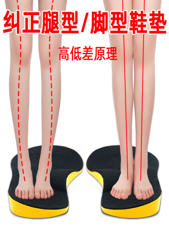 Walking Shoe Inserts Corrector X O Type Leg Posture Orthopedic Insoles ...