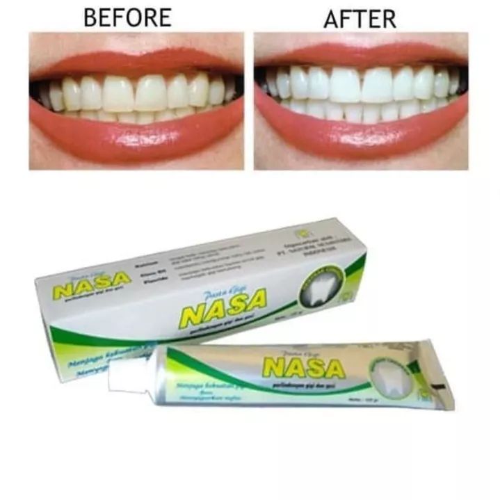 PASTA GIGI NASA HERBAL ORIGINAL / PGN / ODOL NASA / PERONTOK KARANG ...
